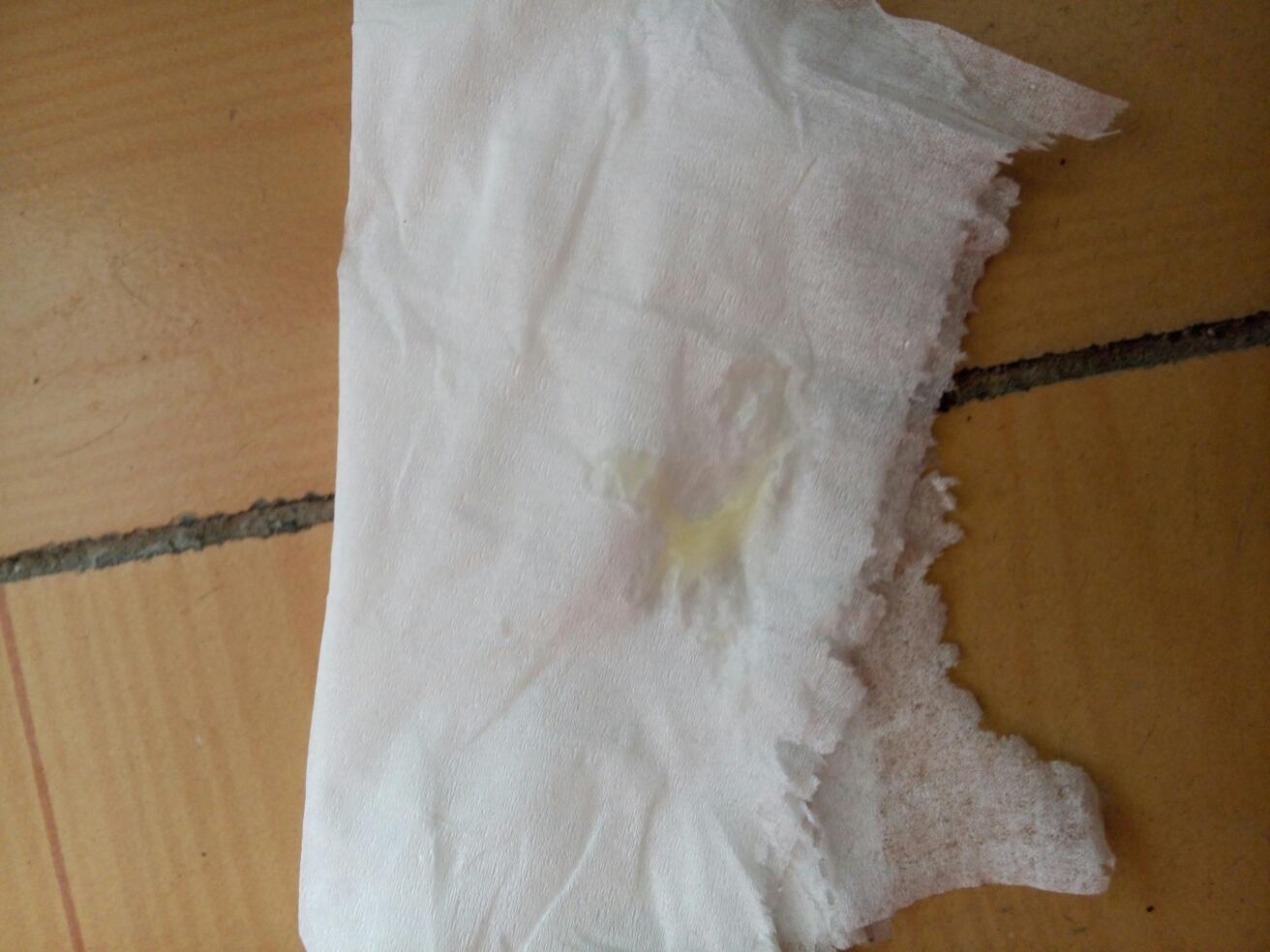 有阴道炎,有图慎入,不知该可用药么 百度宝宝知道